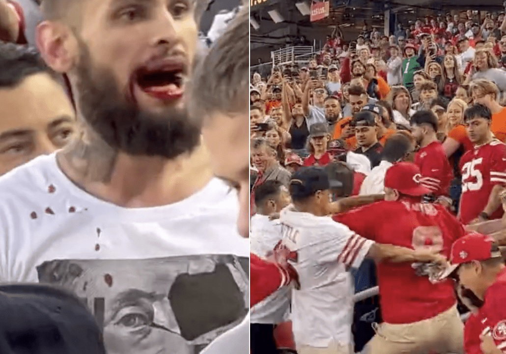 Massive Bloody Brawl In The Stands During 49ers-Broncos Preseason Game ...