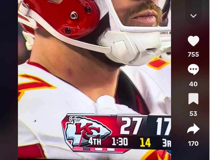 Swifties Convinced Taylor Swift Gave Travis Kelce A Huge Hickey on His ...