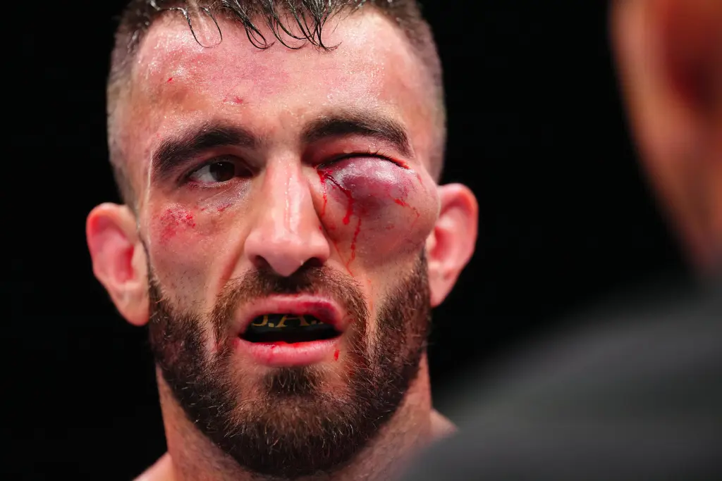 UFC Fighter Mohammad Yahya Endures Gruesome Eye Injury in Disturbing ...