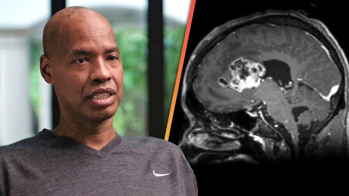 Jason Collins Reveals Singapore Trip for Experimental Cancer Treatment ...