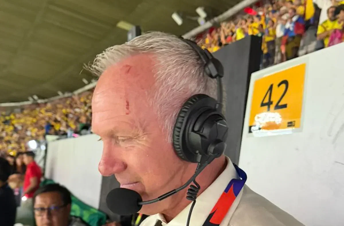 Fox World Cup Reporter Bloodied After Being Struck by Object Thrown ...